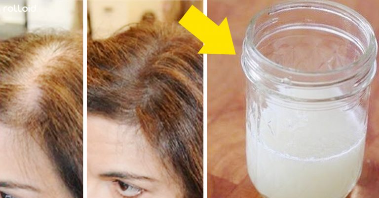 Cómo hacer que el pelo crezca más rápido utilizando cebolla