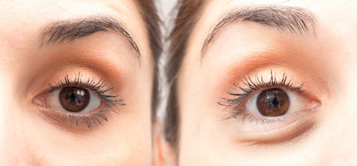 3 Cosas que tienes en casa para acabar con las ojeras en menos de 10 ...