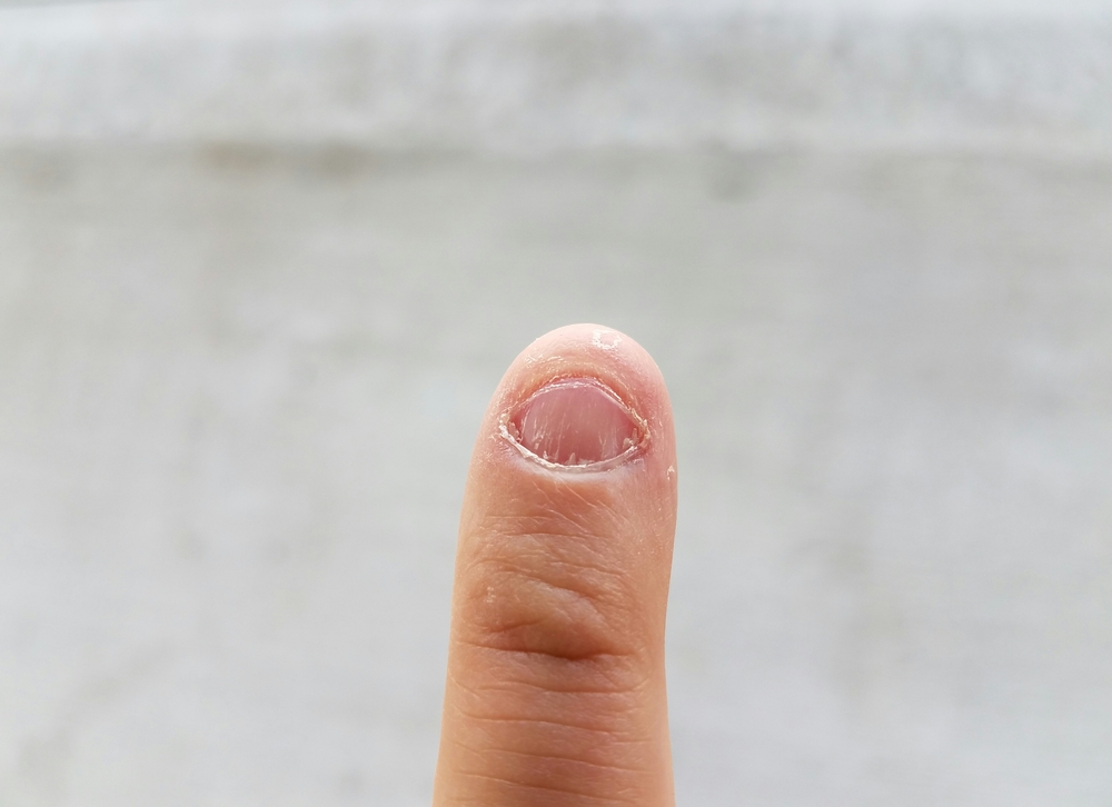 Estas son las 6 razones por las cuales no deberías morderte las uñas