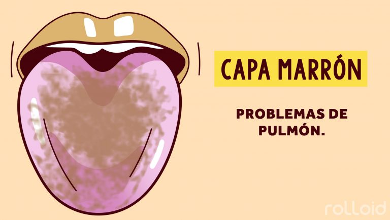 13 Cosas que puedes saber al instante mirando el color de tu lengua