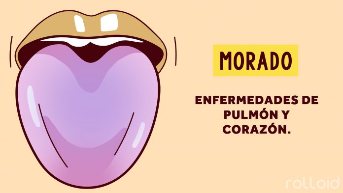 13 Cosas que puedes saber al instante mirando el color de tu lengua