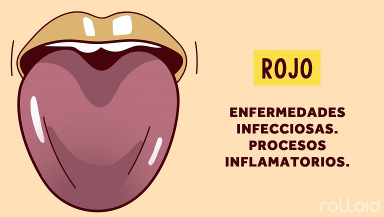 13 Cosas que puedes saber al instante mirando el color de tu lengua
